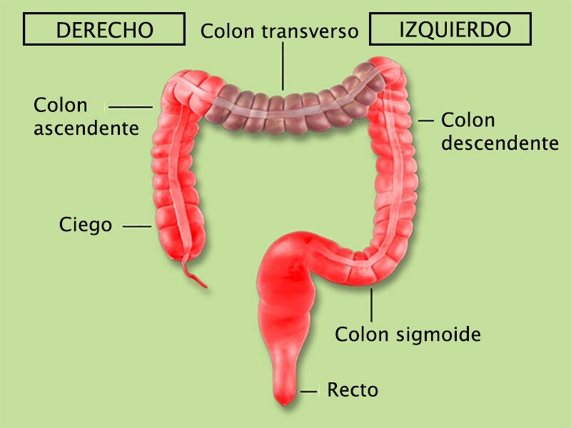 Diferencia En La Localizaci n Del Hemicolon En El C ncer Colorrectal