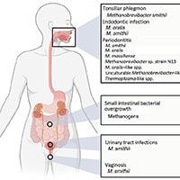 Archaea in the Human Microbiome and Potential Effects on Human ...