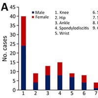 Pneumococcal Septic Arthritis among Adults, France, 2010-2018