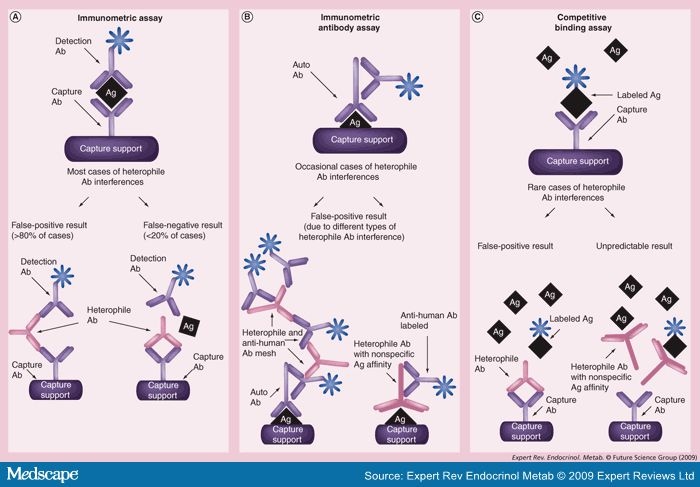 Diagnosis and Management of Thyroid Carcinoma: A Focus on Serum ...