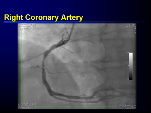 A Clinical Team Dialogue: Choosing the Right Intervention for Patients ...