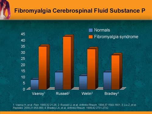 Fibromyalgia Pain Mechanisms: Functional Neuroimaging and Other Factors ...