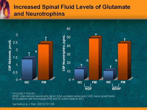 Fibromyalgia Pain Mechanisms: Functional Neuroimaging and Other Factors ...