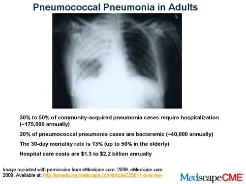Expanding Protection Against Pneumococcal Disease Expert Insights Into