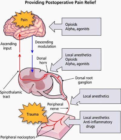 Contemporary Approaches to the Management of Pain in Orthopedic Surgery