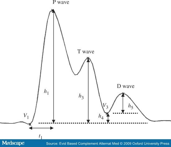 Variation Analysis of Sphygmogram - Page 2