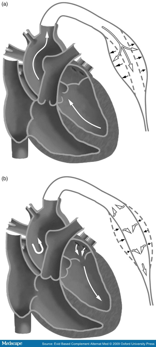 Variation Analysis of Sphygmogram - Page 2