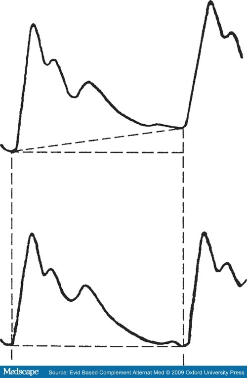 Variation Analysis of Sphygmogram - Page 3