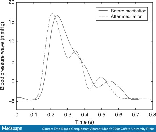 Variation Analysis of Sphygmogram - Page 3