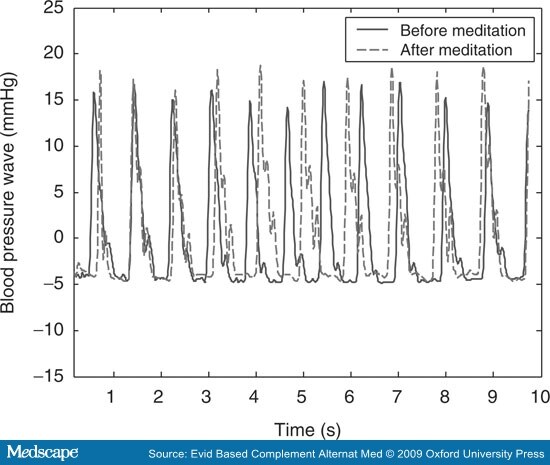 Variation Analysis of Sphygmogram - Page 3