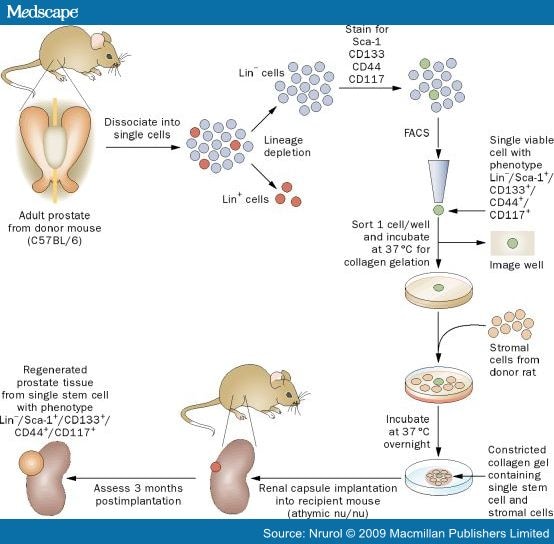 Prostate Cancer: Regeneration of Interest in the Prostate