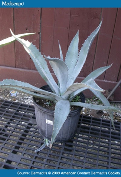 Irritant Contact Dermatitis from Plants - Page 2