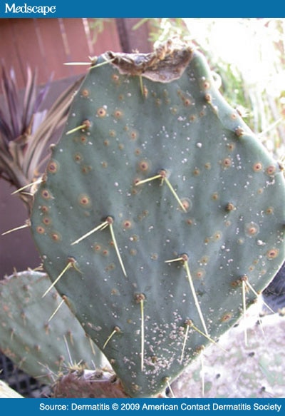 Irritant Contact Dermatitis from Plants - Page 2