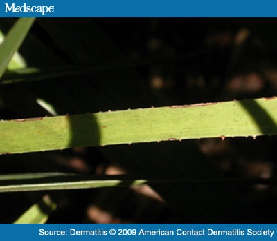 Irritant Contact Dermatitis from Plants - Page 2