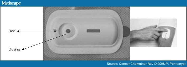 Update in Cancer Pain - Page 4