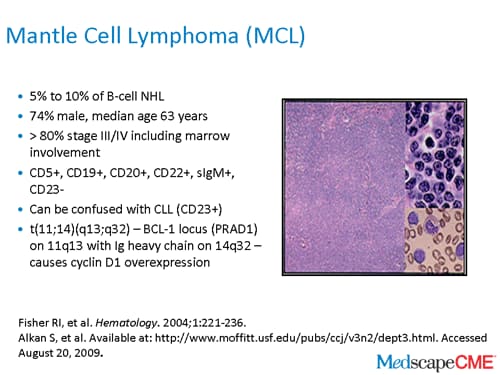 Mantle Cell Lymphoma (Transcript)