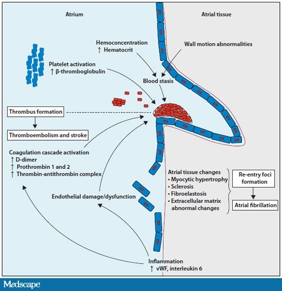 Prevention of Cardiovascular Morbidity Associated With Atrial Fibrillation