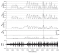 Urodynamic Studies in Pediatric Urology