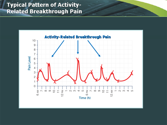 Breakthrough Pain in Cancer Patients: Characteristics, Prevalence, and ...