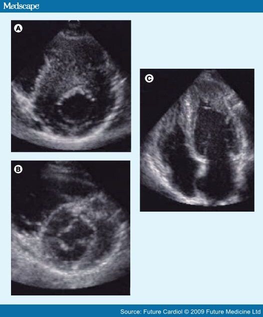 Echocardiography in 2009: The Future of Clinical Diagnosis - Page 3
