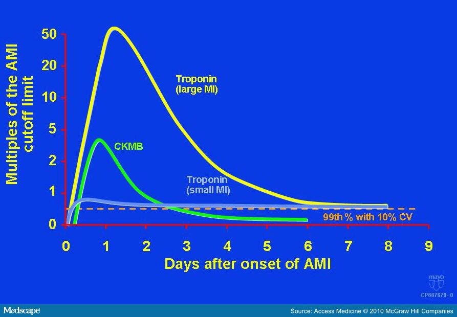 A Universal Definition of Myocardial Infarction for the Twenty-First ...