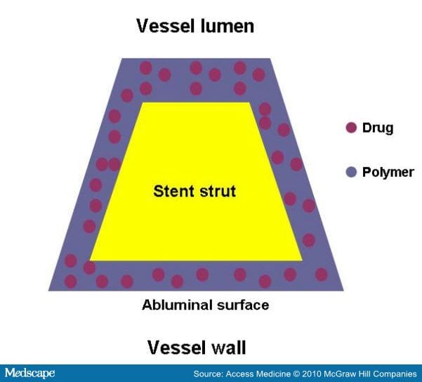 Relative Efficacy of Five Drug-Eluting Stents