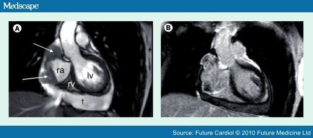 Tumors of the Heart - Page 10
