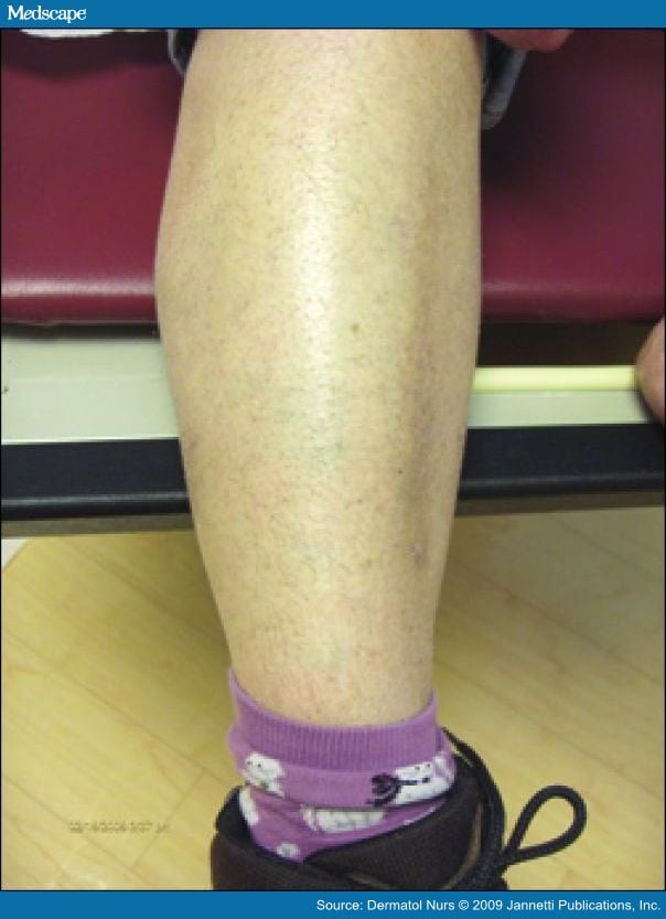 What's Your Assessment? - Page 3