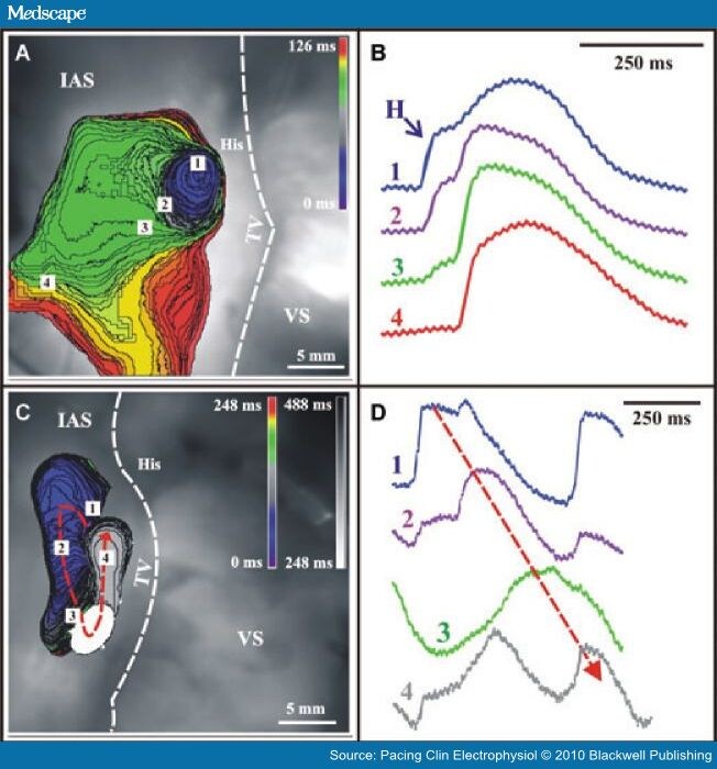 Anatomy and Electrophysiology of the Human AV Node - Page 3
