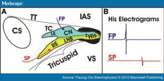 Anatomy and Electrophysiology of the Human AV Node - Page 4
