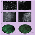 Advances in Fluorescence Imaging Techniques to Detect Oral Cancer - Page 2