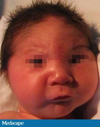 A Neonate With Dysmorphic Facial Features - Page 2