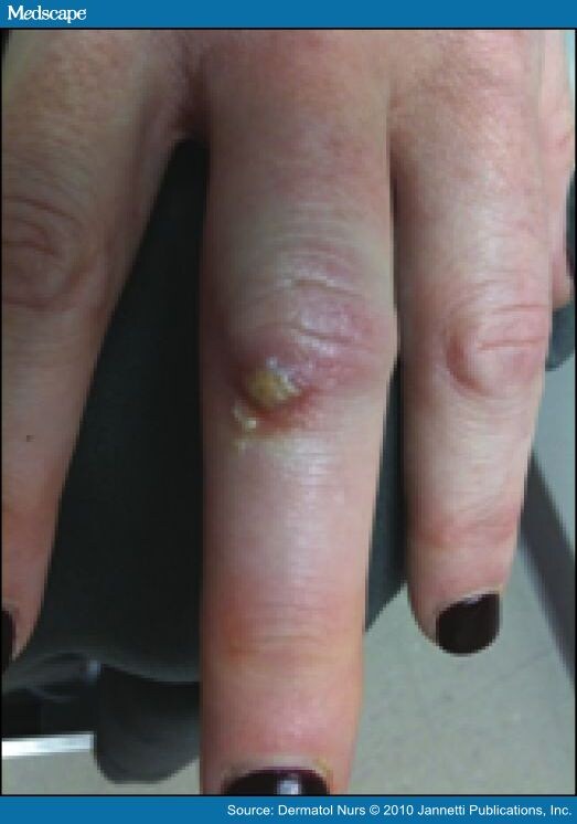 What's Your Assessment? - Page 2