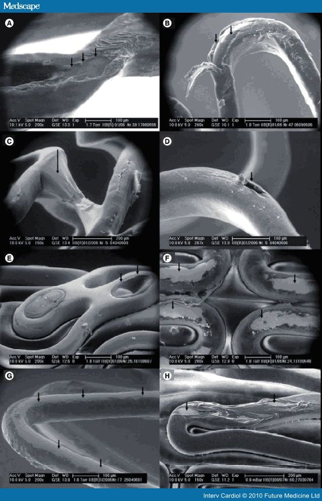 Drug-eluting Stents: The Next Generation
