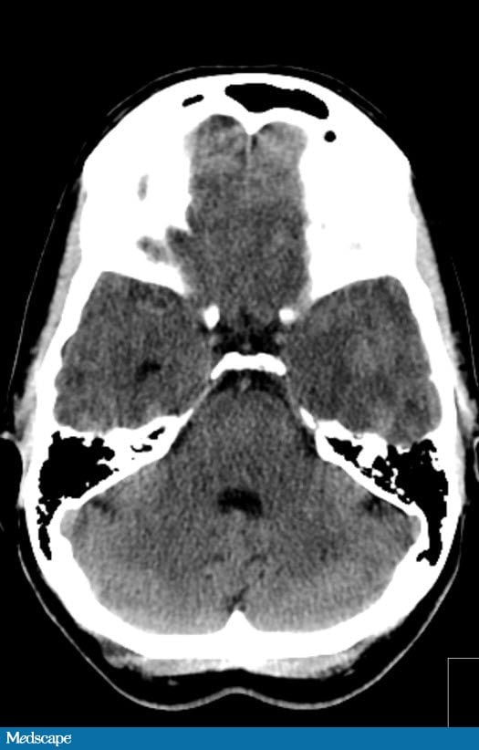 Case Challenge: Panic Attacks or Something Else?