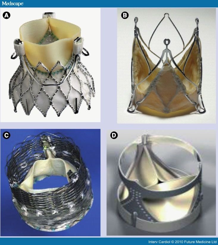 Transcatheter Aortic and Mitral Valve Interventions: Update 2010 - Page 3