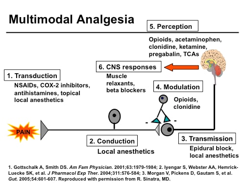 Multimodal Analgesia in Ambulatory Surgical Settings: What’s Needed ...