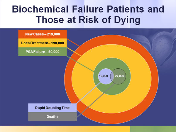 Prostate Cancer: Testosterone's Role in Treatment Decisions and Outcomes
