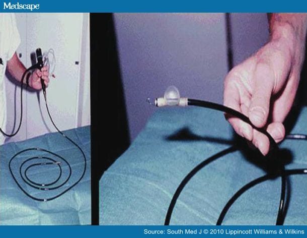 Double Balloon Push Enteroscopy