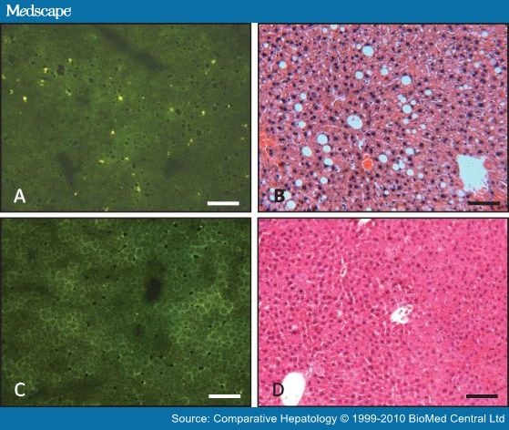 HCV: Transfer of Splenocytes to Study Cell-mediated Immune Responsesg ...