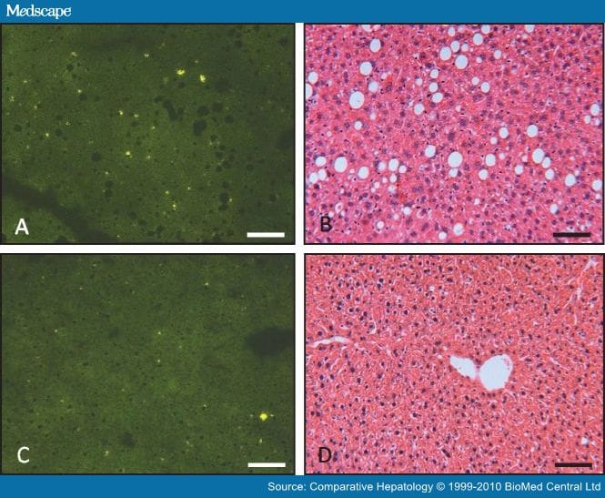 HCV: Transfer of Splenocytes to Study Cell-mediated Immune Responsesg ...