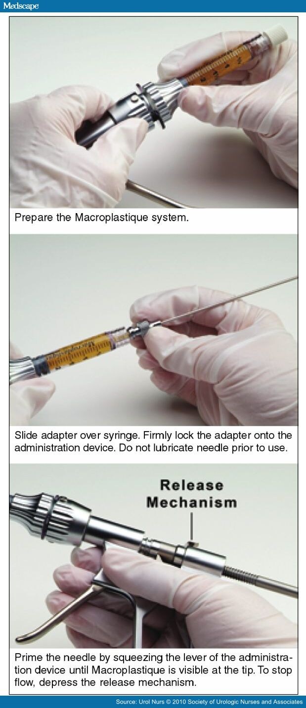 Urology Explained Bladder Bulking