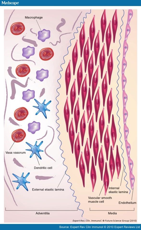 Management of Giant Cell Arteritis and Polymyalgia Rheumatica - Page 5