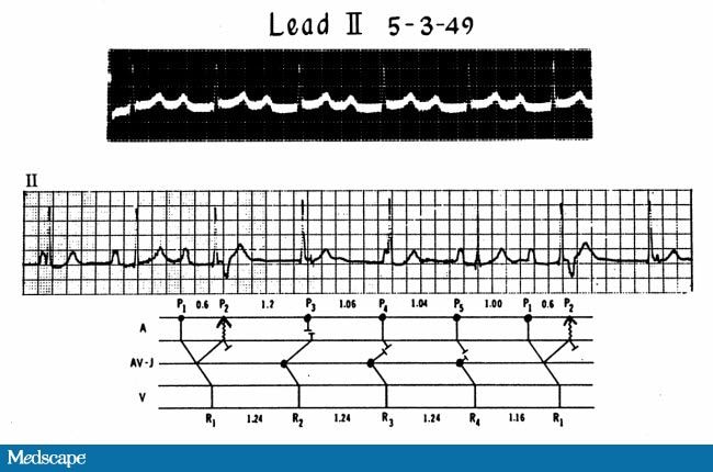 What Is the Primary ECG Disorder? - Page 2