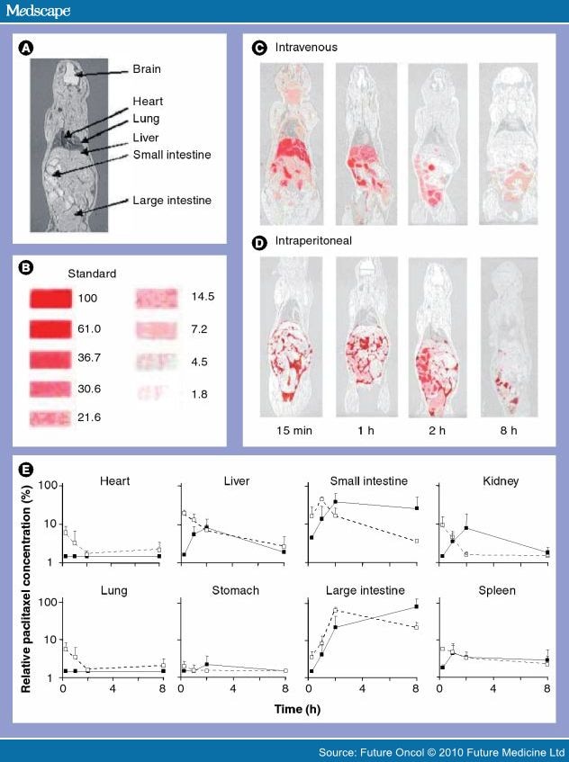 Intraperitoneal Therapy for Peritoneal Cancer - Page 6