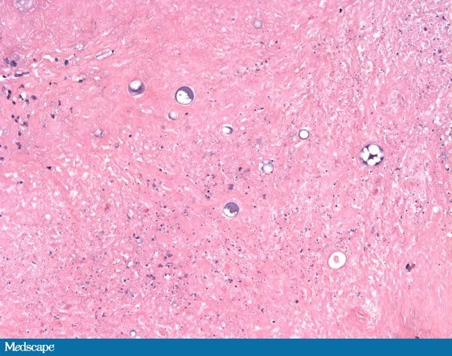 The Mystery of the Multiple Enlarged Lymph Nodes