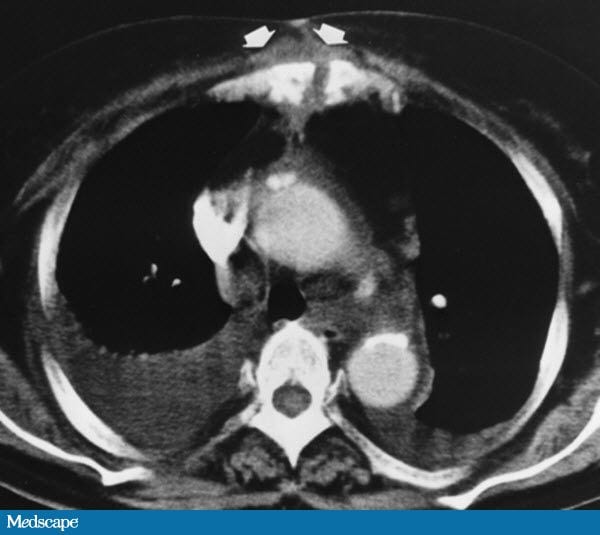 Infectious Disease Consult: What's in Your Waiting Room?
