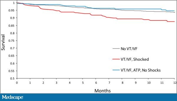 Appropriate Shocks in Primary Prevention of ICD Patients