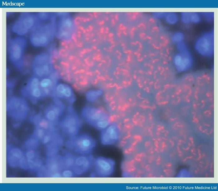 Pseudomonas aeruginosa Biofilms in Cystic Fibrosis - Page 3