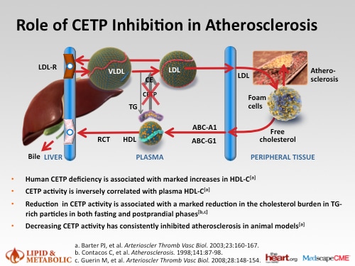 Novel CETP Inhibitors in Clinical Development (Transcript)